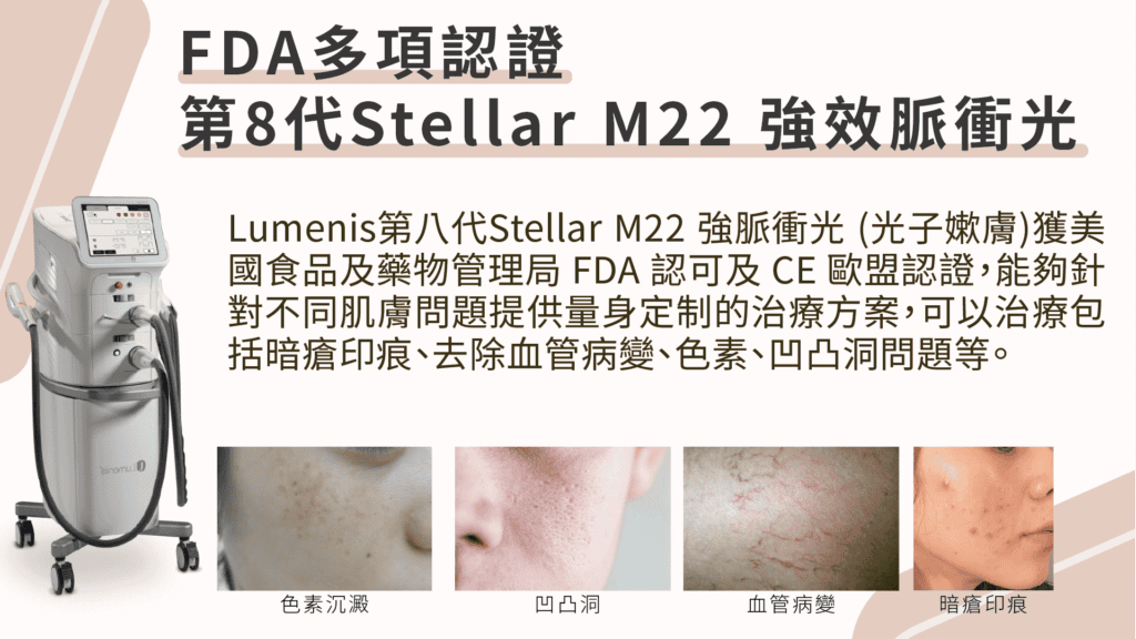 Stellar M22 Resurfx - Beverly Skin